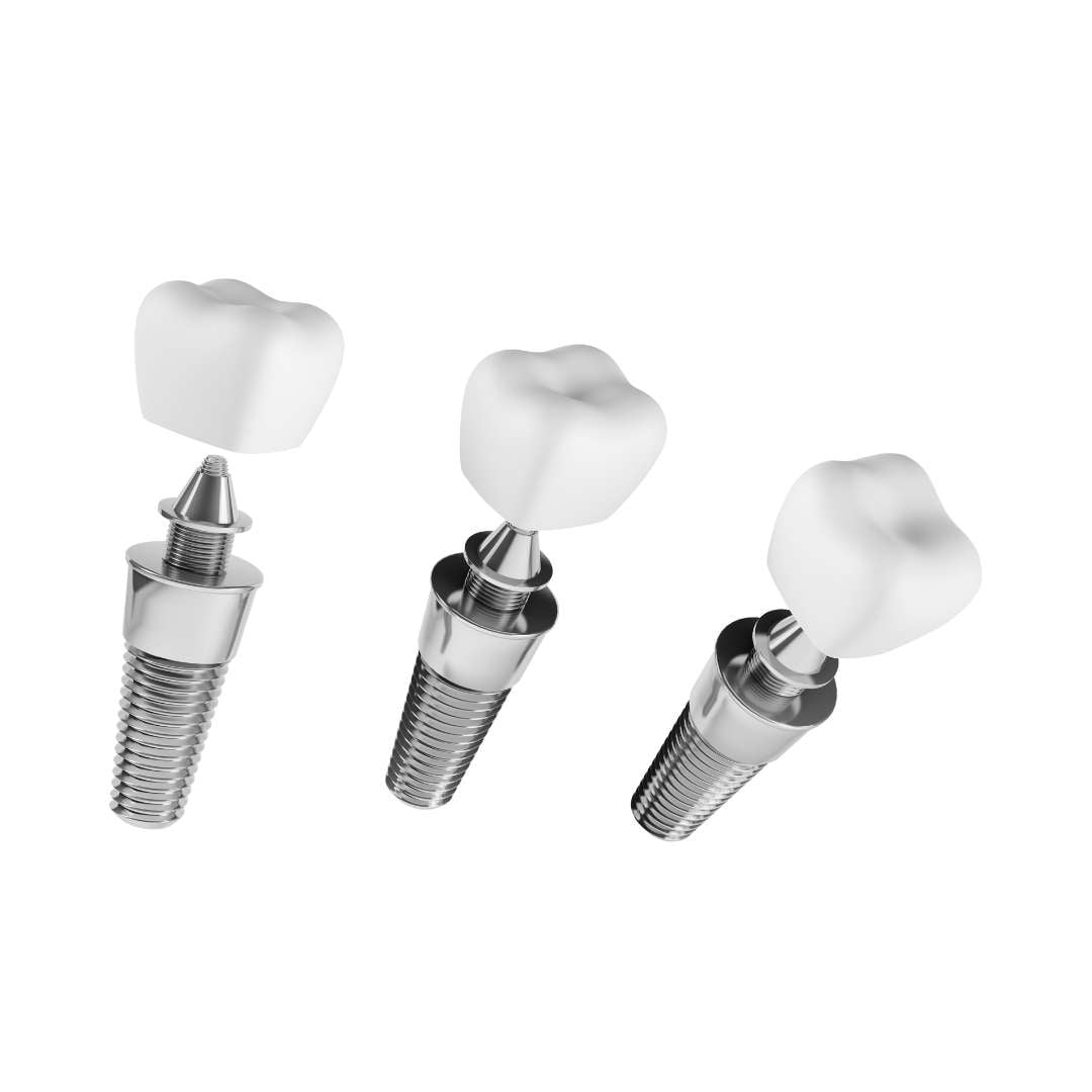 Dental Implant - BioArtDental | The Best Dental Clinic in Kolkata